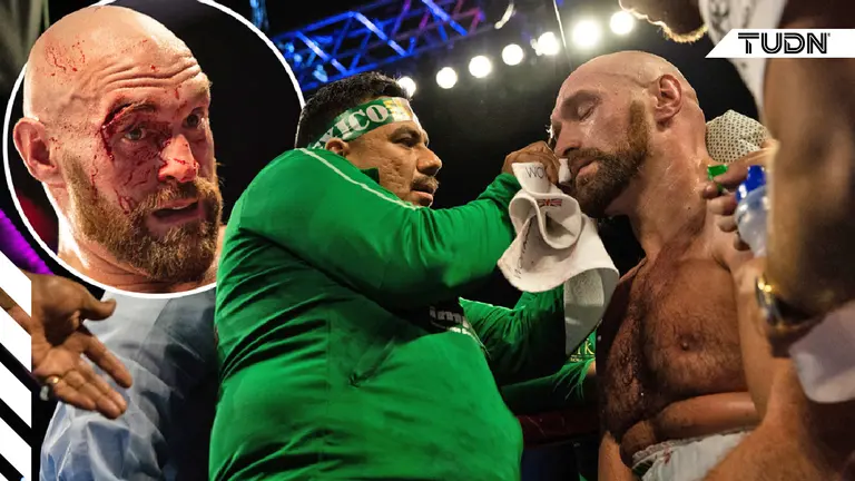 Exclusiva con Jorge Capetillo, el salvador mexicano de Tyson Fury ...