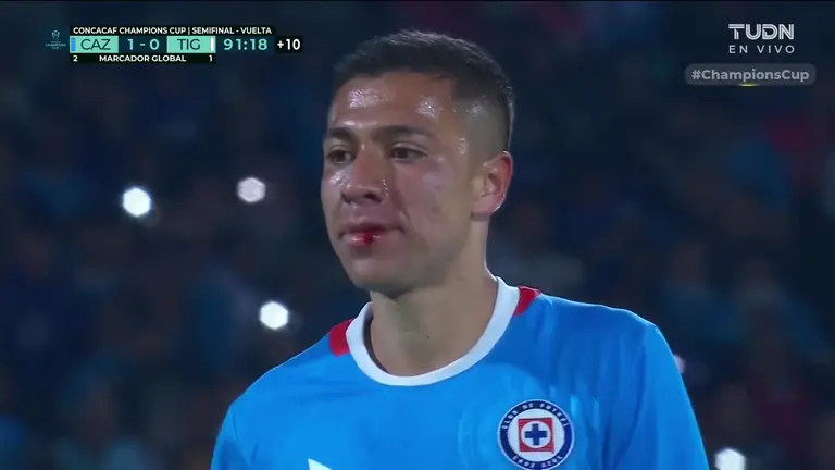 Montaño termina con el labio roto, ¿Qué le pasó al 10 de Cruz Azul ...