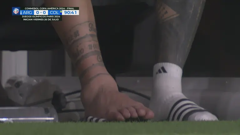 ¡Así quedó el tobillo de Lionel Messi tras la barrida de Arias! | TUDN ...