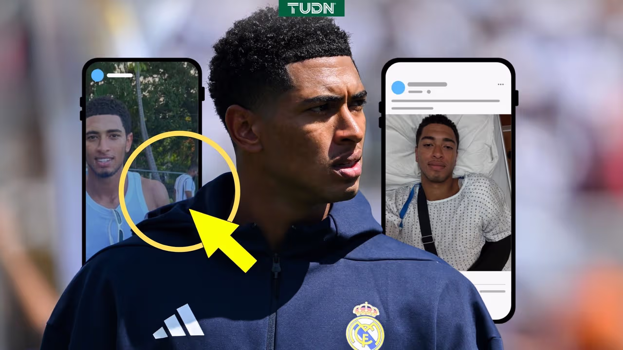 ¡Fan revela por error ESCALOFRIANTE cicatriz de Jude Bellingham! | TUDN ...