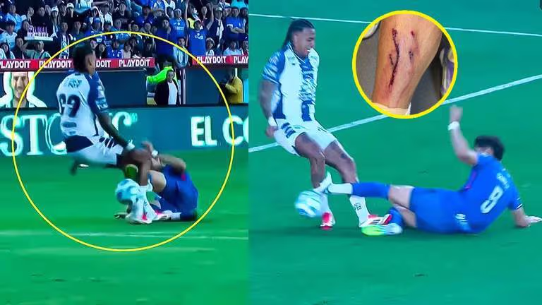 Terrible herida de Chiquete tras ser expulsado al minuto 19 | TUDN Liga ...