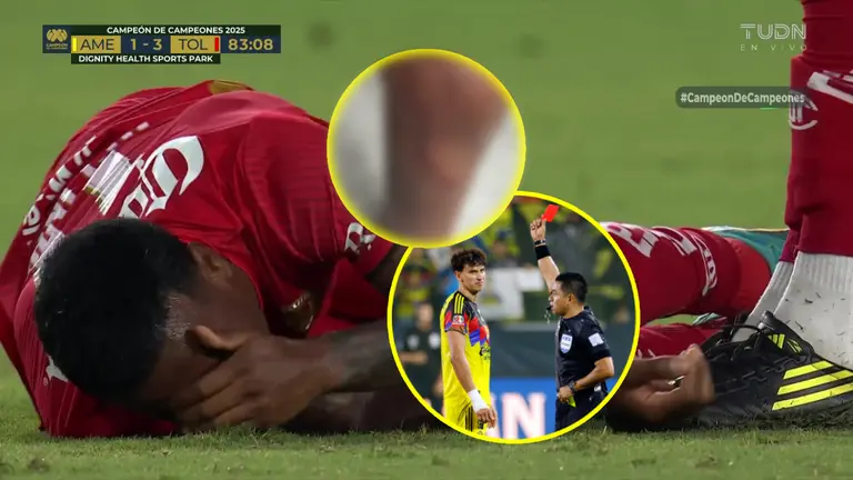 Helinho muestra su herida por dura entrada de Lichnovsky en el Campeón ...