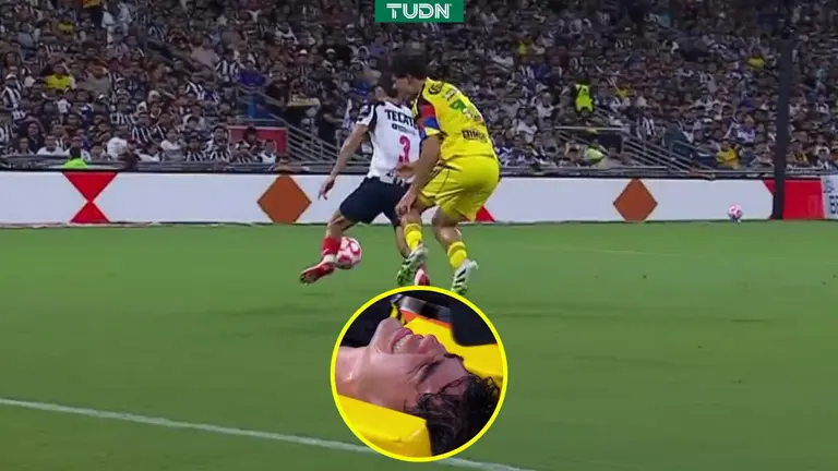 (Required)Monterrey vs. América, Dagoberto Espinoza sale lesionado ...