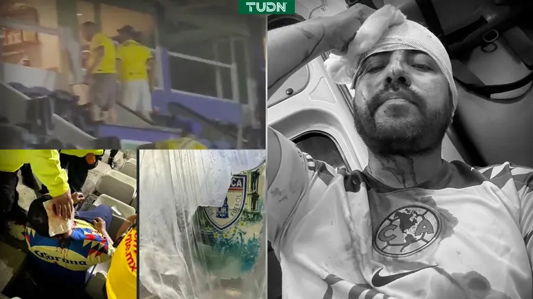 ¡Termina mal el Pachuca vs América! Aficionado es descalabrado | TUDN ...