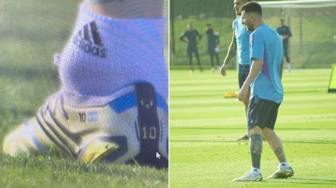 ¡Que susto! Circula foto de Messi con el tobillo inflamado | TUDN ...