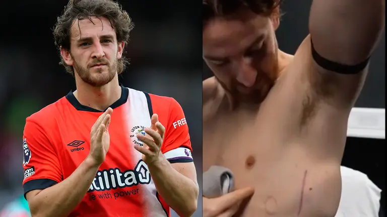 Tom Lockyer, jugador del Luton Town, muestra el desfibrilador que le ...