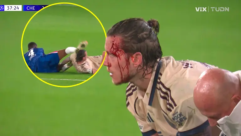 ¡Imágenes fuertes! ¡Wout Weghorst sufre impactante corte en el rostro ...