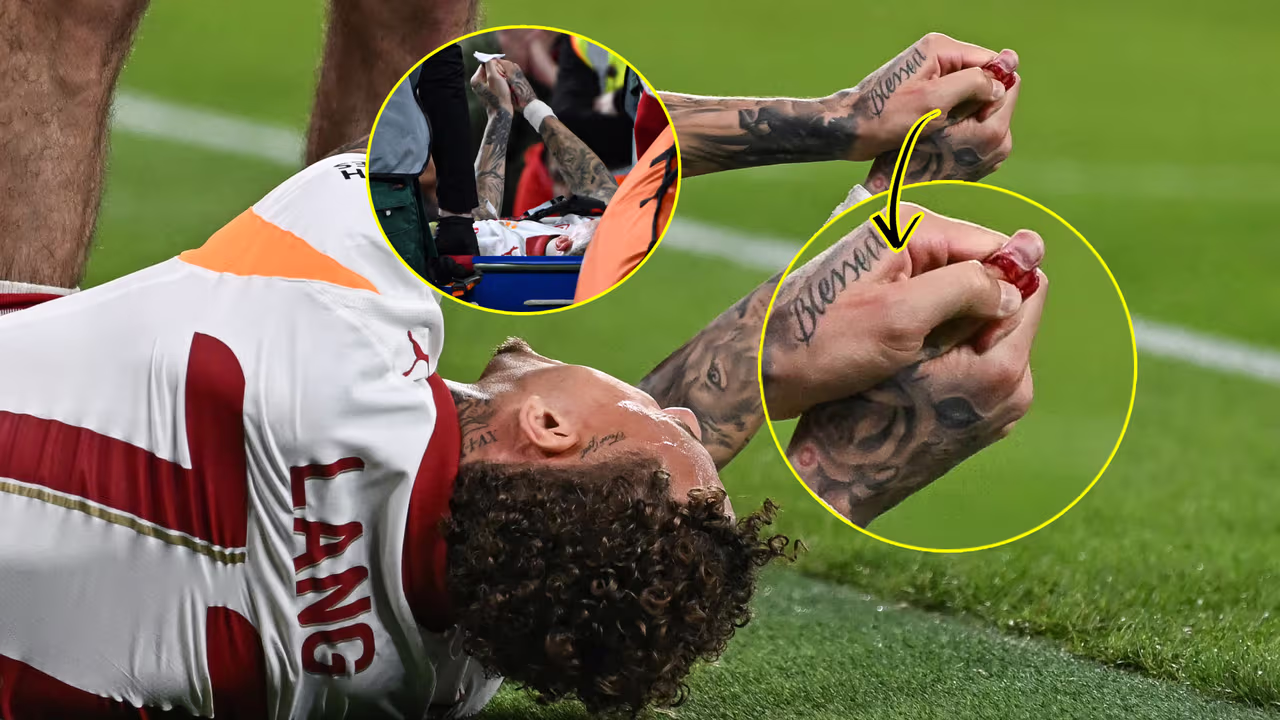 ¡Noa Lang sufre grave lesión en dedo de la mano! | TUDN UEFA Champions ...