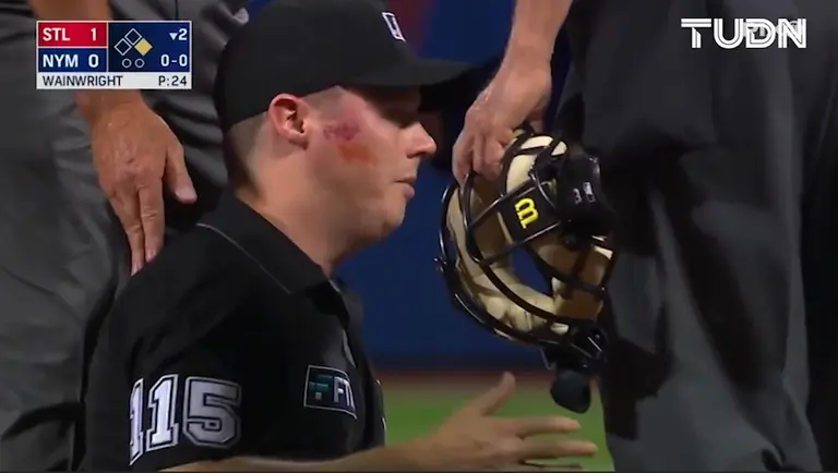 ¡Ouch! Brutal pelotazo al umpire en Grandes Ligas | TUDN MLB | TUDN